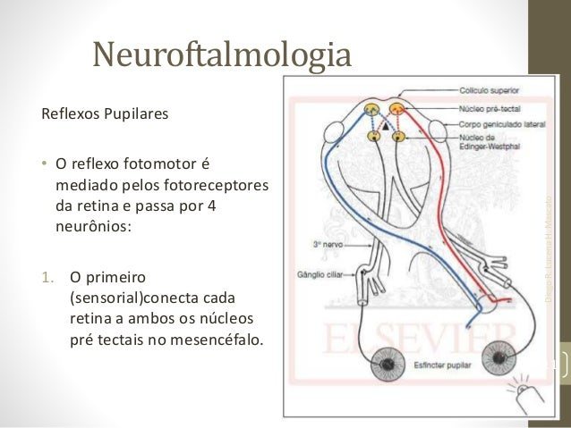 Neuroftalmologia parte II