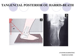 Estudo Radiológico do Tornozelo | PPT