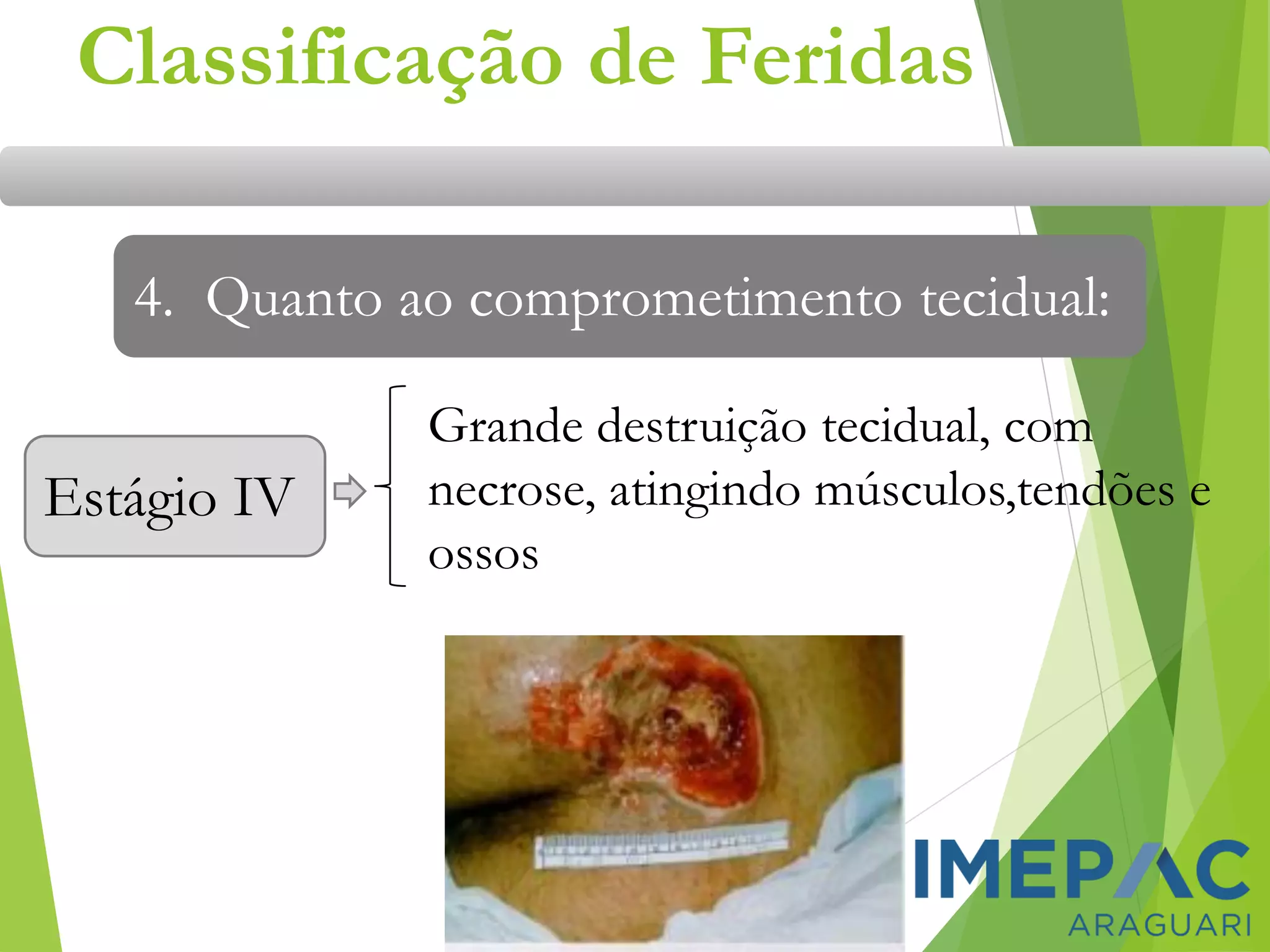 AULA - FERIDAS E CURATIVOS.pdf