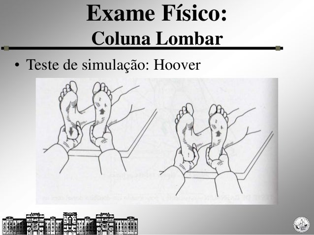 Procedimentos espinhais guiados por neuroimagem