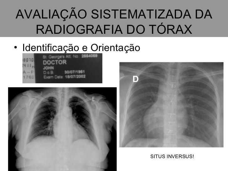 Aula PráTica 1 TóRax Normal