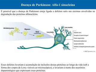 Aula Snc Tratamento Da Doença De Parkinson Ppt