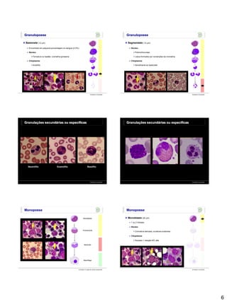 Aula 02 hematologia - slides 2 | PDF