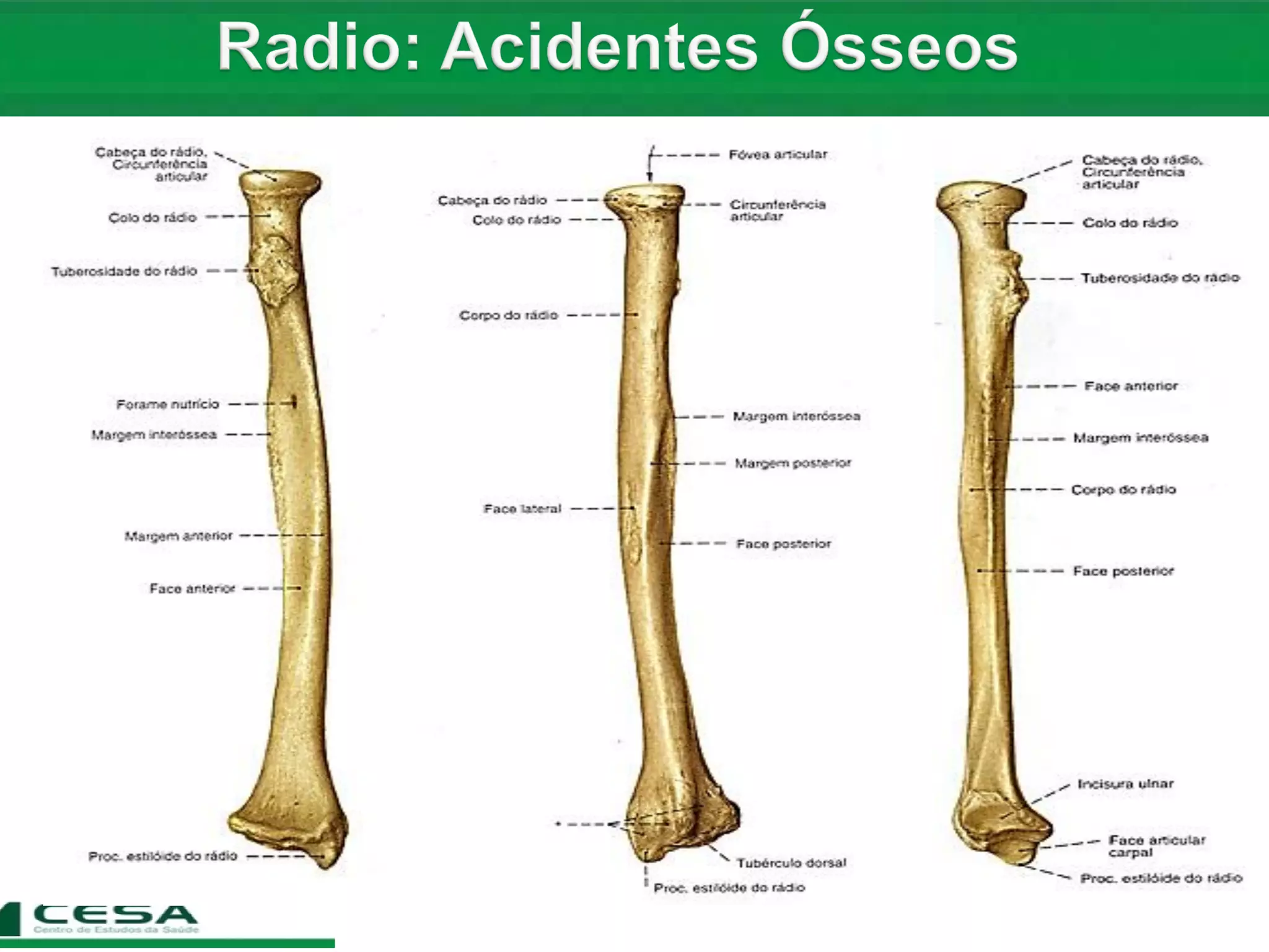 Aula 03 radiologia - anatomia do esqueleto apendicular - radio e ulna | PDF
