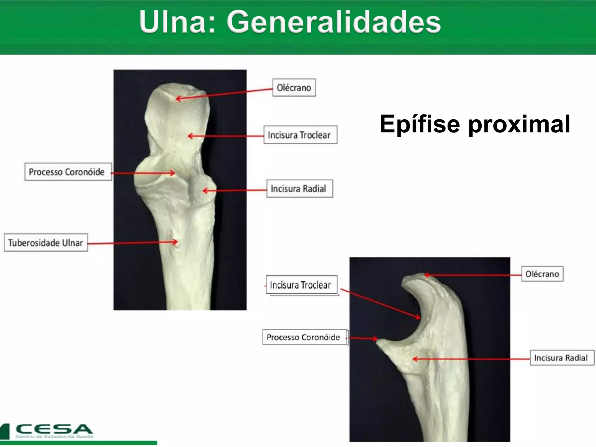 Aula 03 radiologia - anatomia do esqueleto apendicular - radio e ulna | PDF