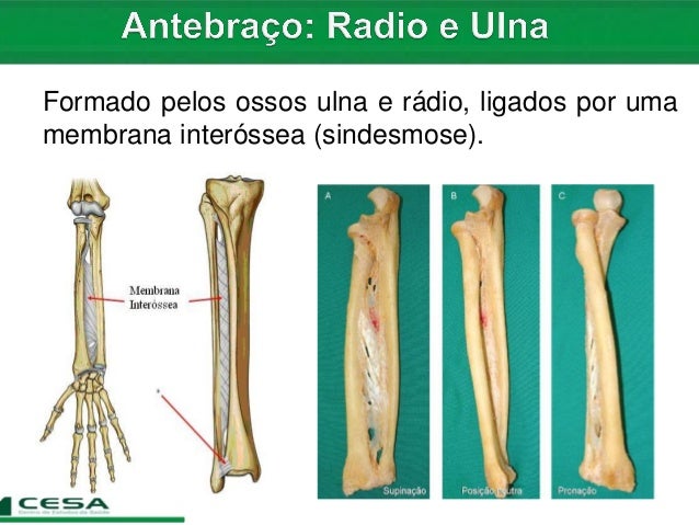 Aula 03 radiologia - anatomia do esqueleto apendicular - radio e ul…