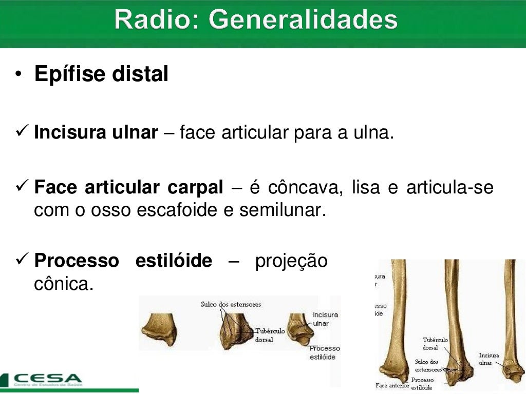 Aula 03 radiologia - anatomia do esqueleto apendicular - radio e ul…