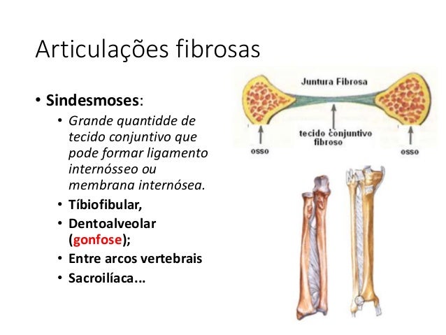 Aula 03 sistema articular