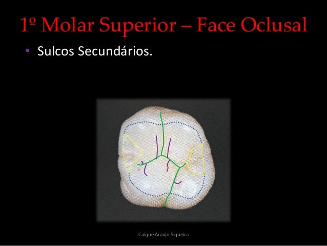 Aula 08 molares superiores