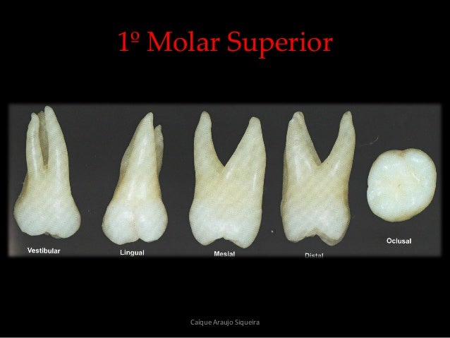 Aula 08 molares superiores