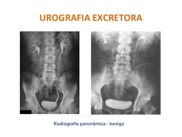 Radiologianota10 Turma 88 - urografia excretora