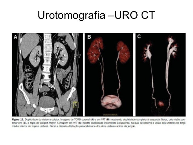 Radiologianota10 Turma 88 - urografia excretora