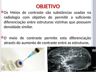 INTRDUÇÃO AOS MEIOS DE CONTRASTE NA RADIOLOGIA | PPTX