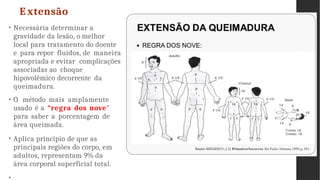 Assistência de Enfermagem a Vítima de Queimaduras.pptx