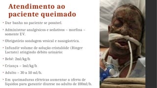 Assistência de Enfermagem a Vítima de Queimaduras.pptx