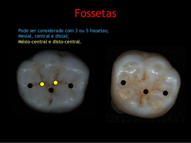 Molares Inferiores - Caique A. SIqueira - Anatomia Dental