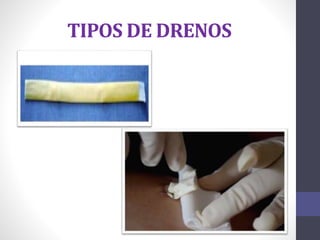 Aula 15.1 Cuidados com Drenos.pptx
