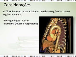 Aula 1 Tórax.pptx
