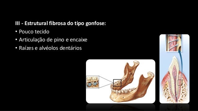 Aula 3 - anatomia I - artrologia e sindesmologia - Fama
