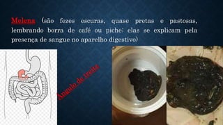 Doenças gastrointestinal - parte I | PPT