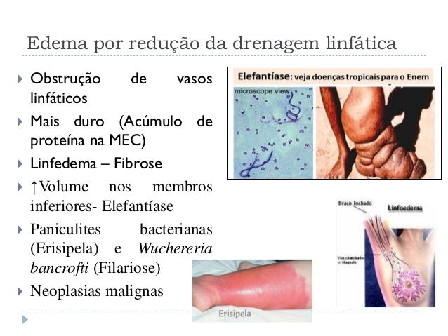Aula 8 edema