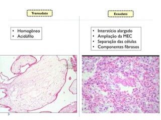 aula de edema e circulacao patologia geral | PDF