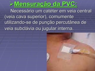 Pressão Venosa Central - PVC e Técnica de Verificação. | PDF