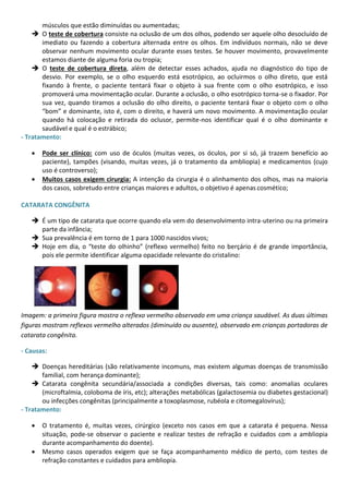 AULA ALTERAÇÕES OCULARES NA INFANCIA.pdf