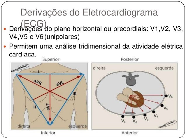 Aula arritmias e interpretação de ECG