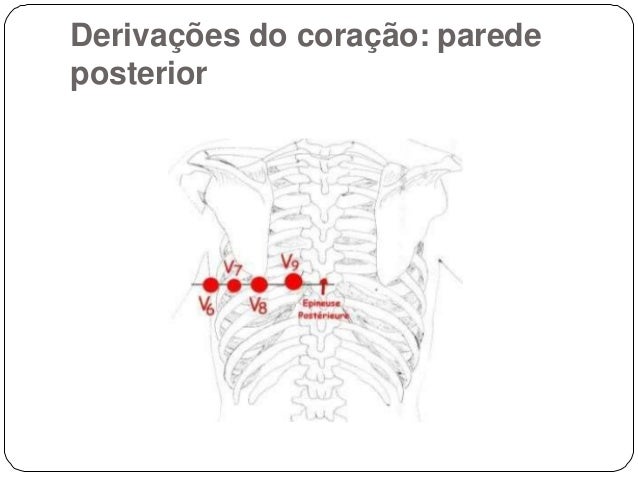 Aula arritmias e interpretação de ECG
