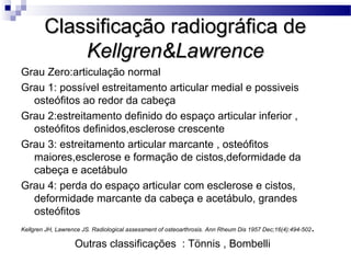 Aula Coxartrose e Artroplastia total do quadril | PPT