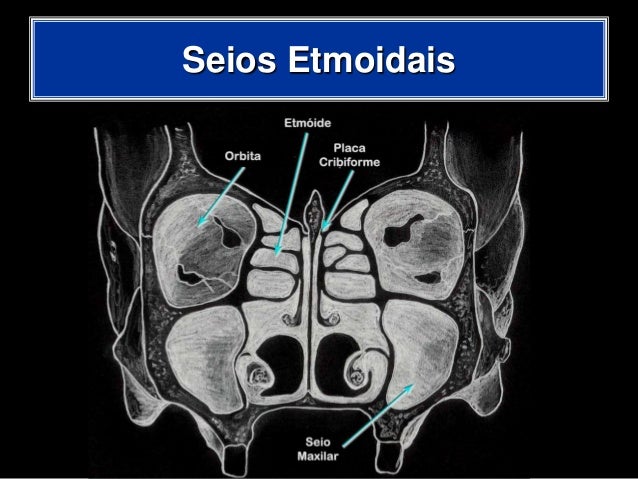 Aula científica sobre seios paranasais, cavum e vias aéreas superiore…