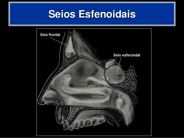 Aula científica sobre seios paranasais, cavum e vias aéreas superiore…