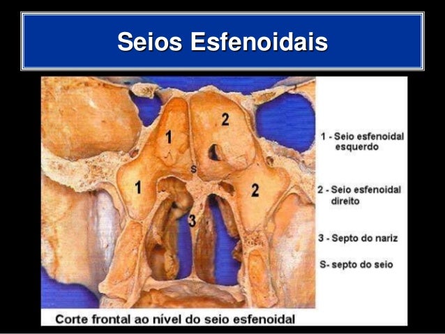 Aula científica sobre seios paranasais, cavum e vias aéreas superiore…
