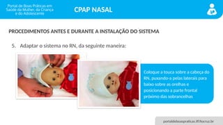 ventilação mecânica cpap nasal enfermagem | PPT