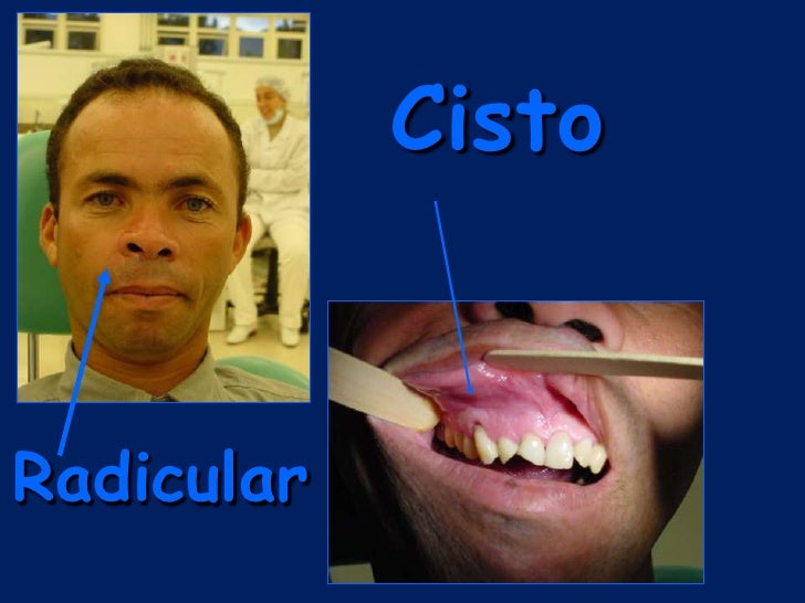Aula De Cistos Uninove 2009 2003