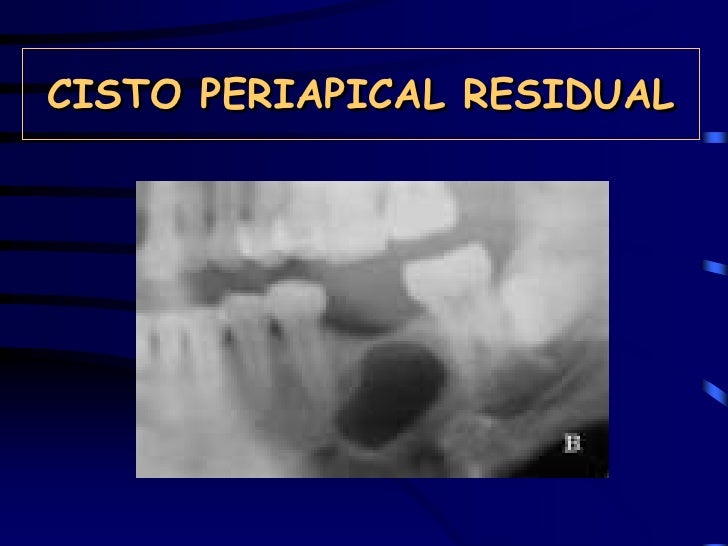 Aula De Cistos Uninove 2009 2003