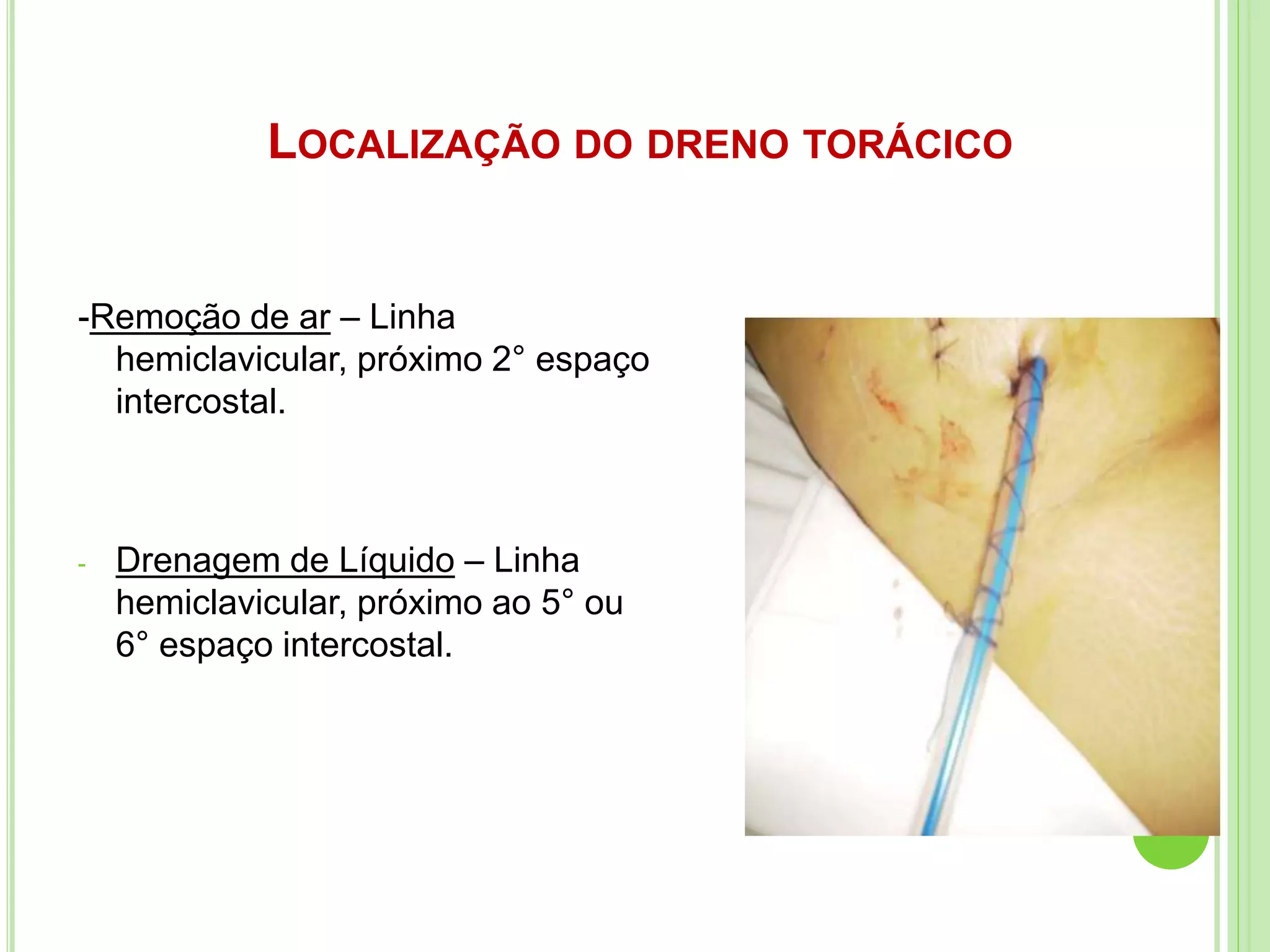 Aula de cuidados com drenos | PPT | First Aid | Injuries