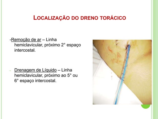 Aula de cuidados com drenos | PPT | First Aid | Injuries