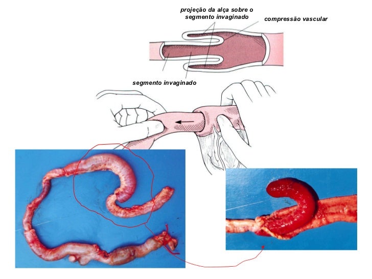 Aula de digestivo parte 2