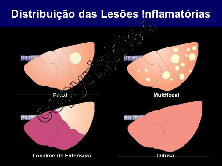 Aula de Inflamacao