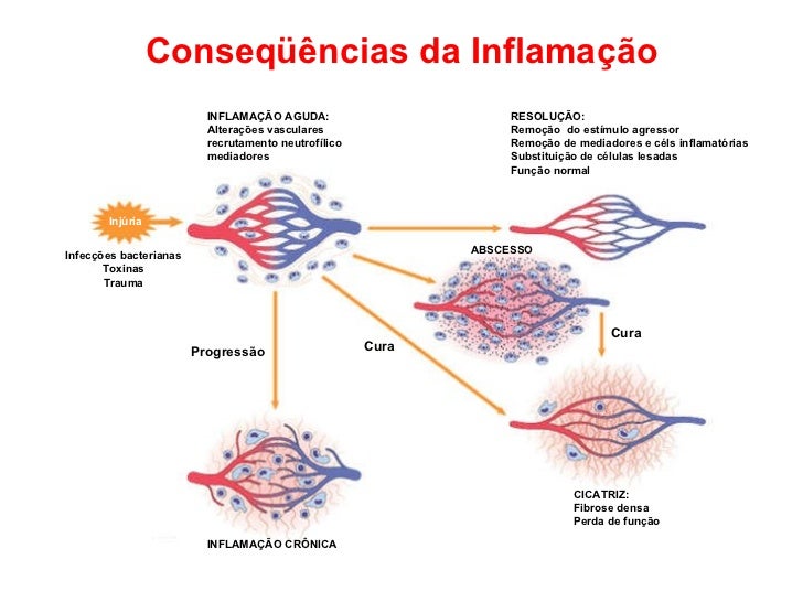 Aula de Inflamacao