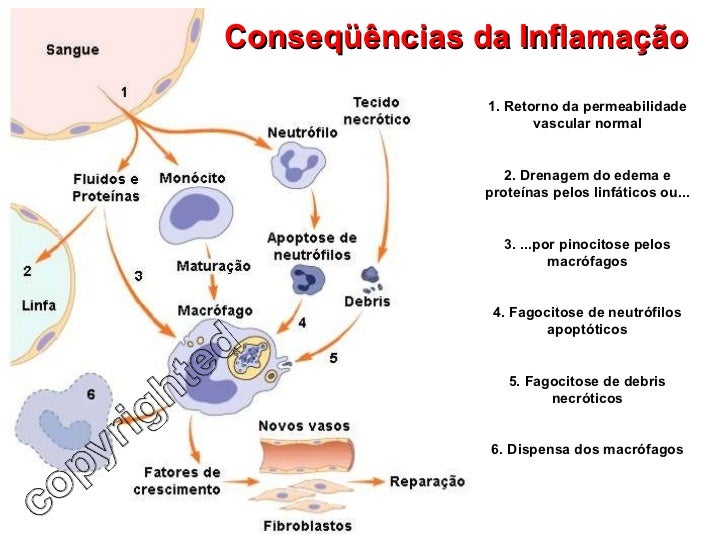 Aula de Inflamacao