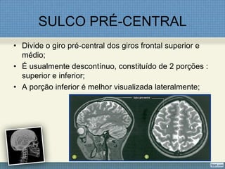 Aula de neuroanatomia | PPT