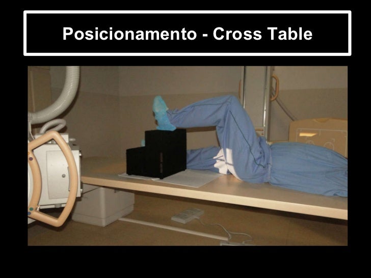 Aula sobre quadril, série para sindrome do impacto femoro acetabular