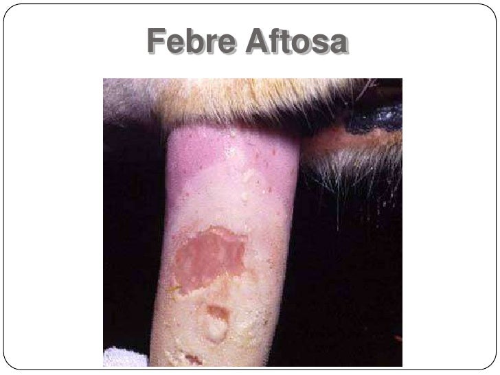 Aula Digestivo 2 2010 1