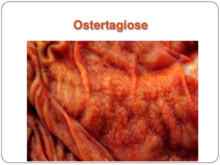 Aula Digestivo 5 2010 1