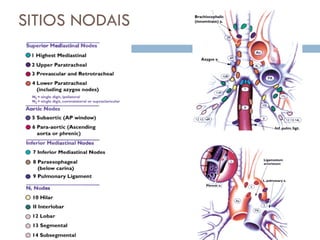 Radiologia torácica: Hilos pulmonares e Doenças do Mediastino | PPT