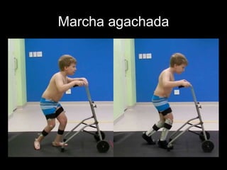 Aula Marcha humana normal.ppt