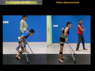 Aula Marcha humana normal.ppt